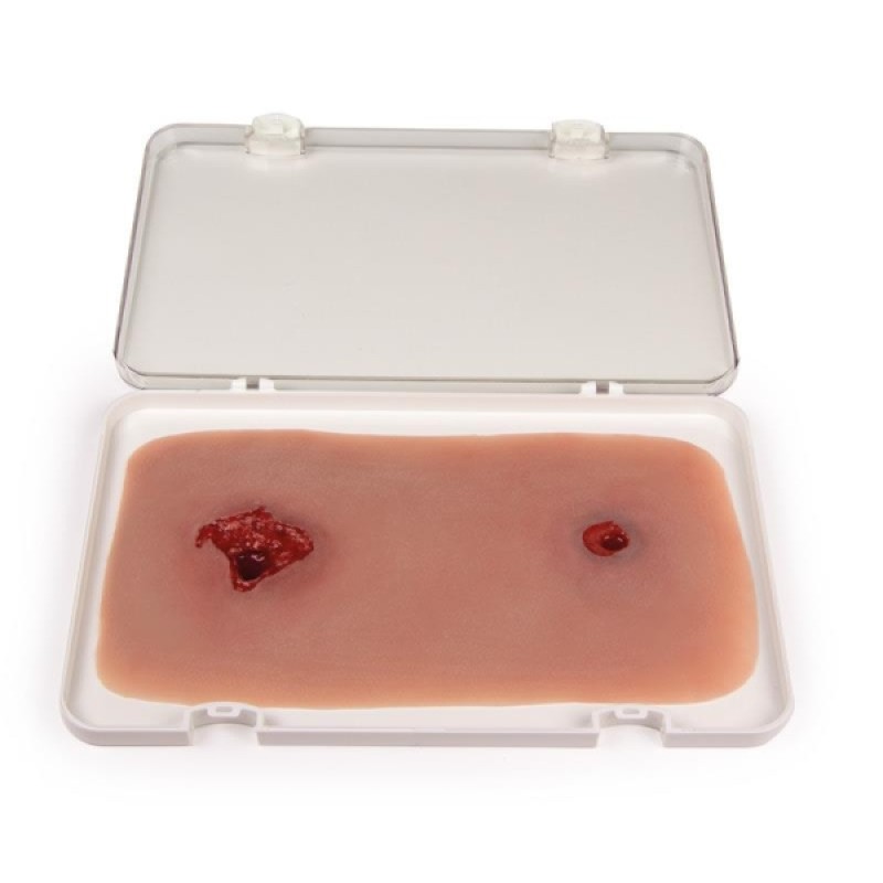 Erler Zimmer Wound Moulage Leg Bullet Wound | Health and Care